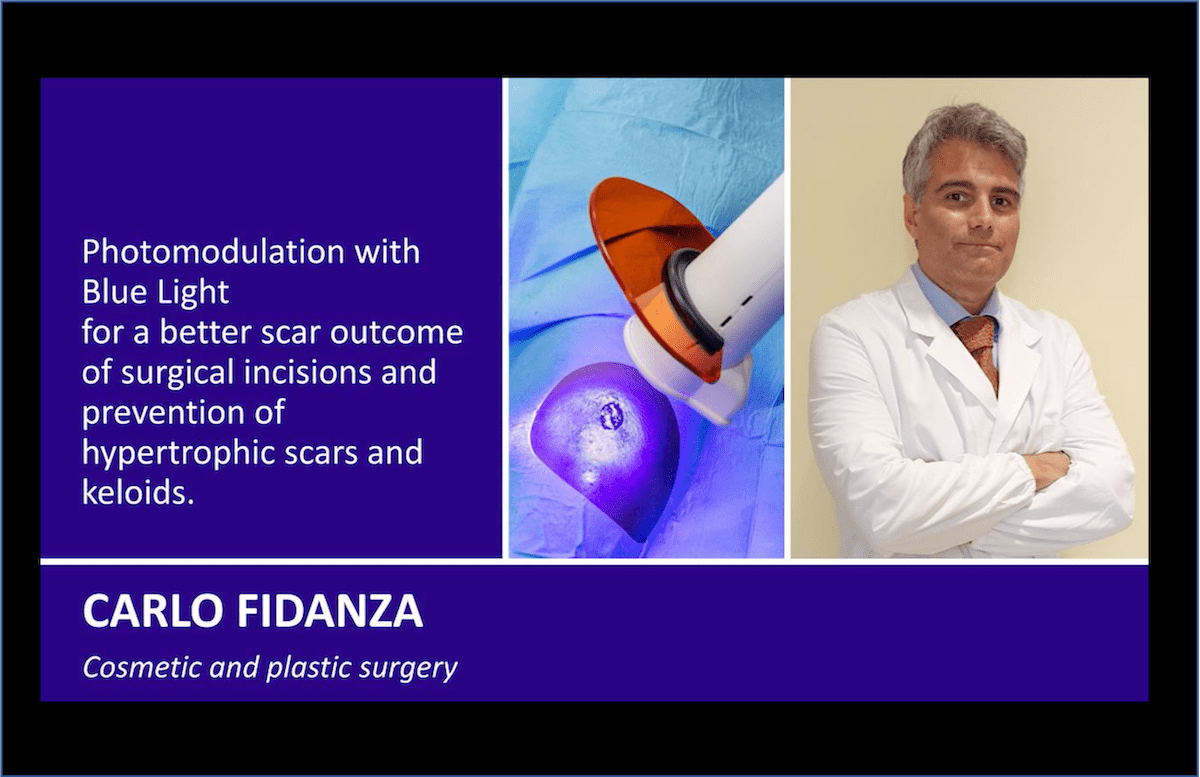 Blue Light Photobio-modulation and scar outcomes - Emoled
