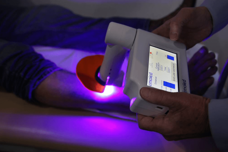 Blue Light a potential "game changer" in the treatment of chronic ...
